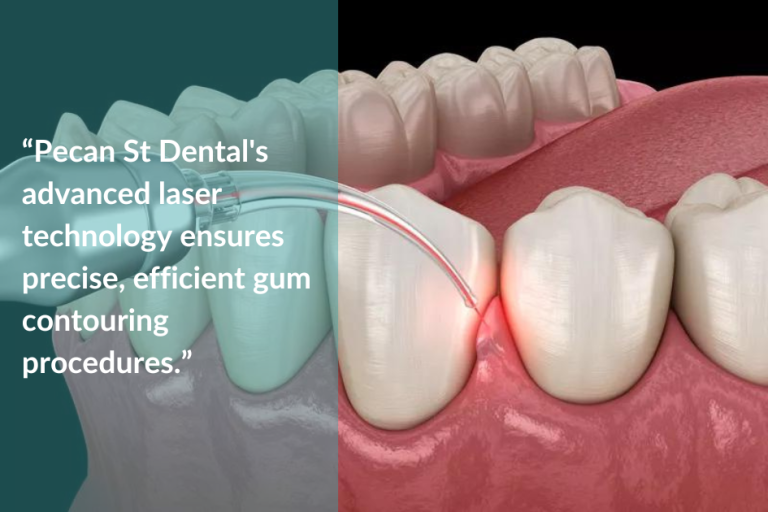 Gum Contouring in Pflugerville, TX - Achieve a Perfect Smile - Pecan St ...