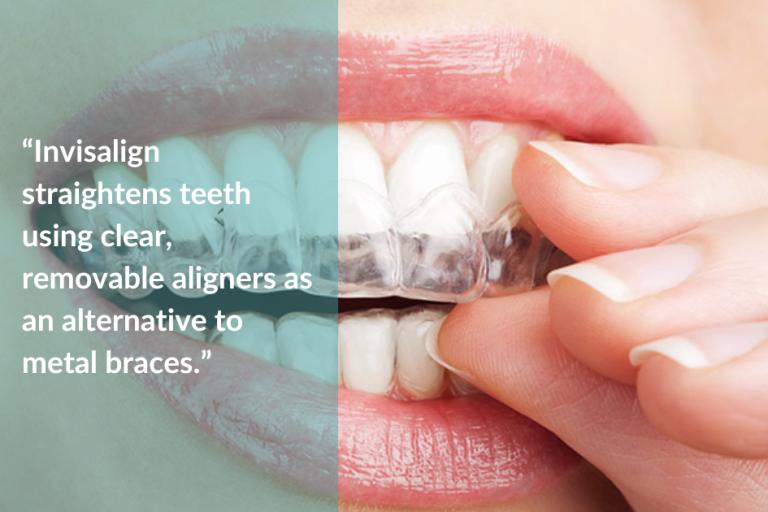 Invisalign in Pflugerville, TX - Transform Your Smile - Pecan St. Dental